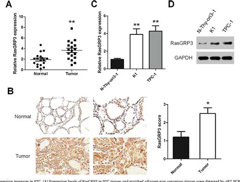 Figure 1 From Rasgrp3 Controls Cell Proliferation And Migration In Papillary Thyroid Cancer By