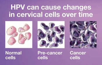 Making Sense Of Your Pap And HPV Test Results