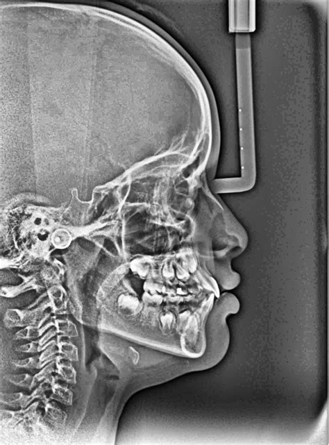 Seg 100 Object Detection Dataset By Seg