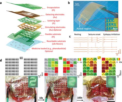Schematic Of Device Configuration And Conformal Mountingworking On Rat