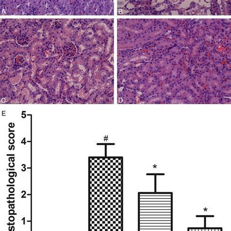 Effect Of Icariin On Cisplatin Induced Renal Tubular Damage Histologic
