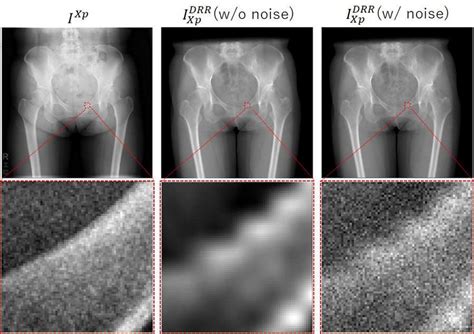 Comparison Between Real And Simulated X Ray Images From Left To Right