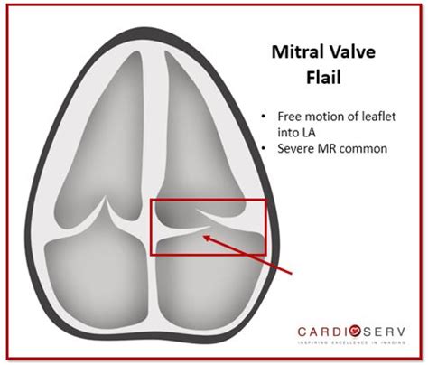 Essential Steps To Evaluating Mr Etiologies Cardioserv