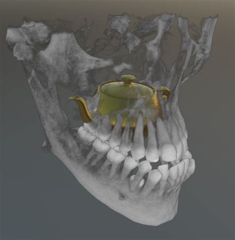 Dicom Add On Evergine