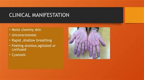 Shockclassification Etiologymanagement For Dental Students Pptx