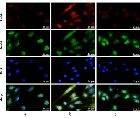 Protection Of H9c2 Myocardial Cells From Oxidative Stress By Crocetin