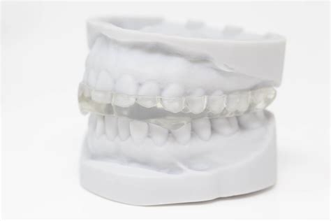 Provisional Splint At Adam Ball Blog