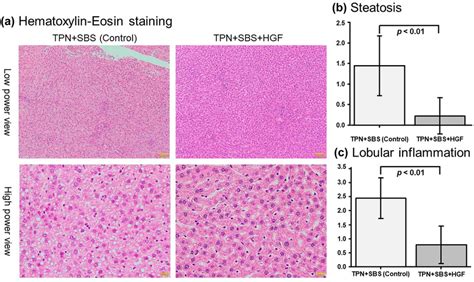 Histological Findings Of Liver Specimens A Hematoxylineosin Staining