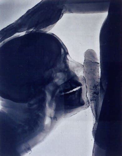 Sex Under Mri Or Xray Porn Pictures Xxx Photos Sex Images 1529946