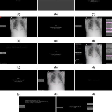 Screens Of The Data Collection Interface In The Sequence They Are