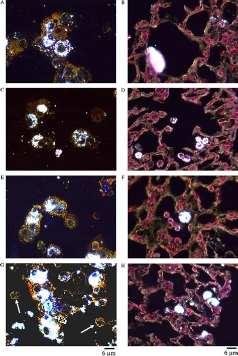 Dark Field Micrographs Of Alveolar Cells Á Macrophages And Neutrophils Download Scientific