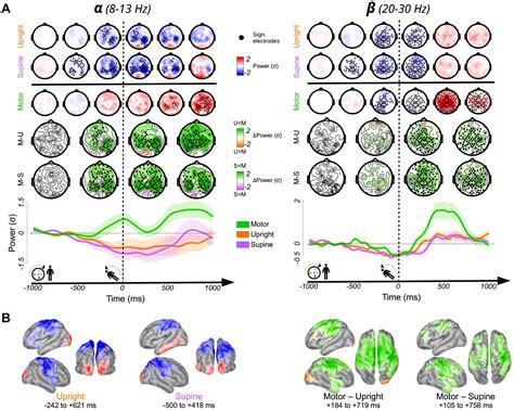 Imageoftheweek Fig Journal Of Neurophysiology