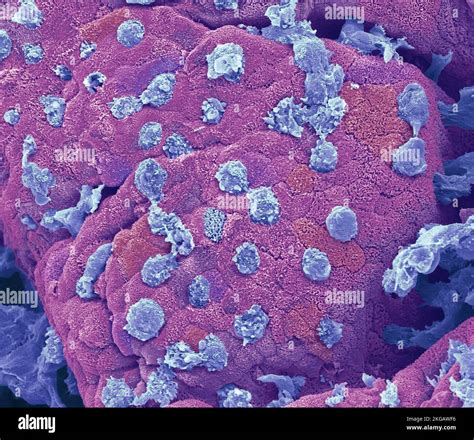 Colon Colour Scanning Electron Micrograph Sem Of The Wall Of The