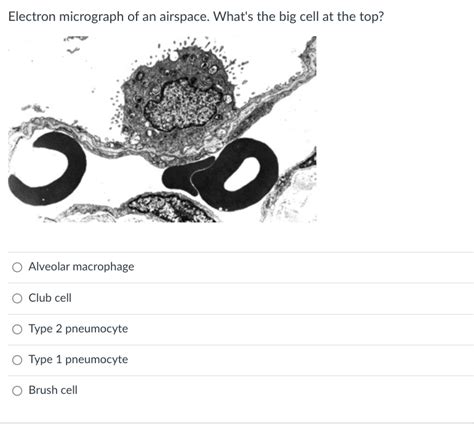 Solved Electron Micrograph Of An Airspace Whats The Big