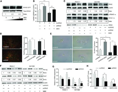 Oncogenic Kras Is Involved In Regulation Of Gem Induced Metabolic