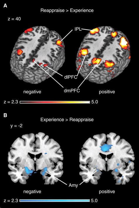 Neural Correlates Of Cognitive Reappraisal And Emotional Experience Download Scientific