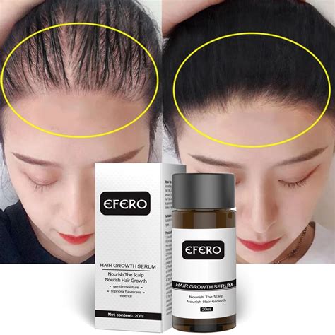 Hair Growth Serum Hyaluronic Acid Fast Hair Growth Essence Anti Loss
