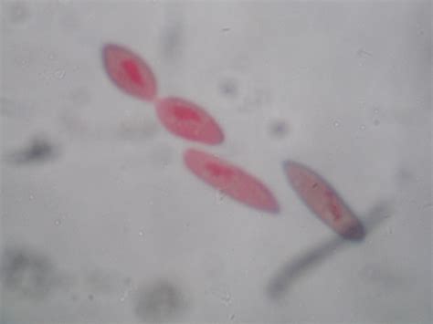 What Is Hpo In Microscope At Emerita Yamamoto Blog