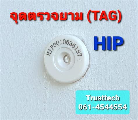 ติดตั้งระบบตรวจสอบการตรวจตรา ของพนักงานรักษาความปลอดภัย Patrol