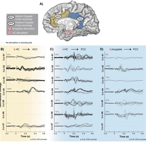 Illustration Of Cortico Cortical Evoked Potentials Cceps Experimental Download Scientific