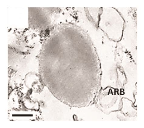 Lycopene Treatment Disrupts Chlamydial Developmental Cycle In Alveolar