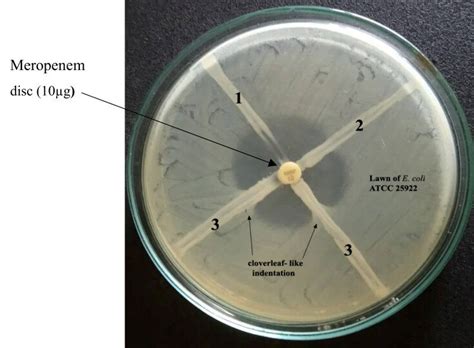 Phenotypic Detection Of Carbapenemase Production By The Modified Hodge