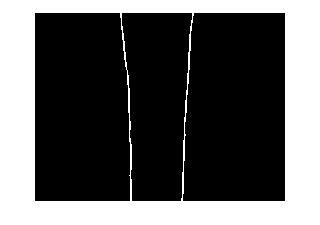 How To Smoothen Edges Found In A Image Using Matlab Stack Overflow