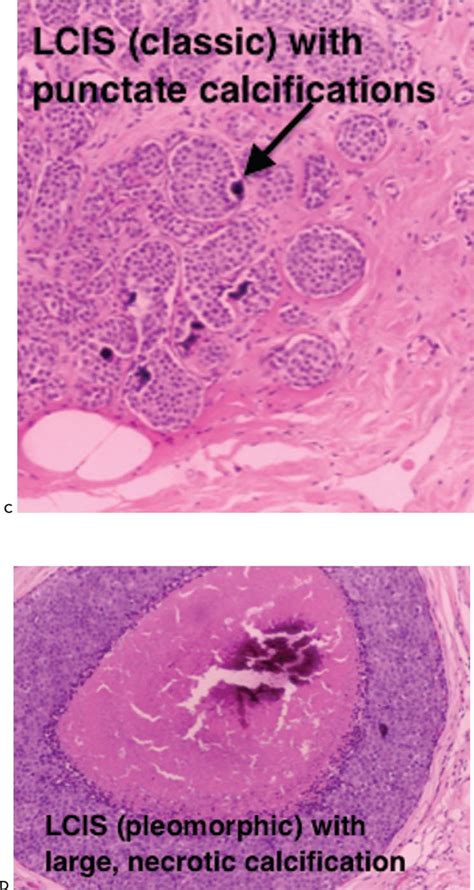 E Punctate Round Radiology Key