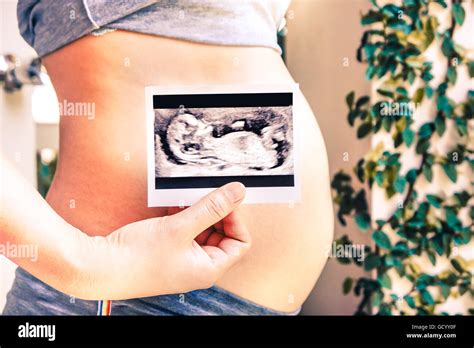 Pregnant Woman Holding Ultrasound Scan Photo Stock Photo Alamy