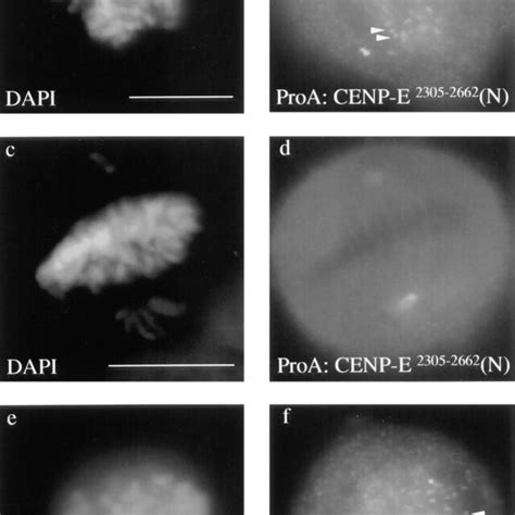 Localization Of The Minimal Kinetochore Binding Domain Download Scientific Diagram