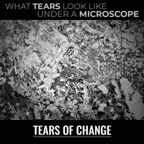 An Unexpected View Of Different Types Of Tears Under A Light Microscope