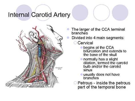 Carotid Artery Disease Anatomy Transverse Aortic Arch