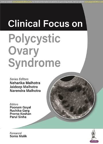 Clinical Focus On Polycystic Ovary Syndrome 1st Edition 2023 College