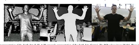 Figure 1 From Clinical Assessment Of Depth Sensor Based Pose Estimation Algorithms For