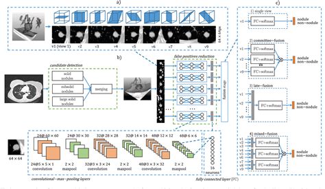 Figure 1 From Pulmonary Nodule Detection In Ct Images False Positive