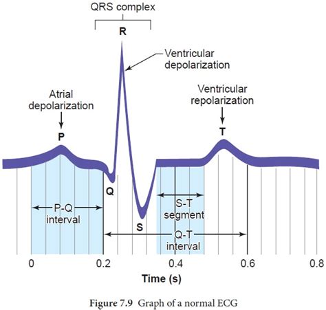 Electrocardiogram Diagram