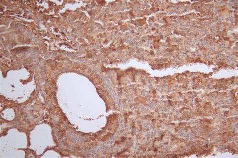 Bax Recombinant Rabbit Monoclonal Antibody 15d9 Invitrogen 100 μl