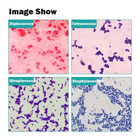 Bacteria Fungus Microscope Slides 510202550 Pieces Microbes Prepared Slides Biological