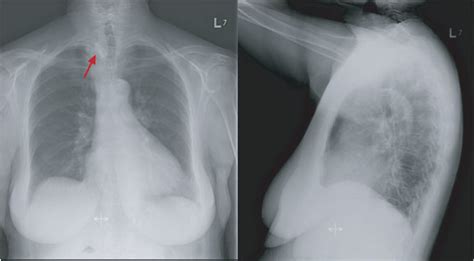 Medical Imaging Toronto Notes