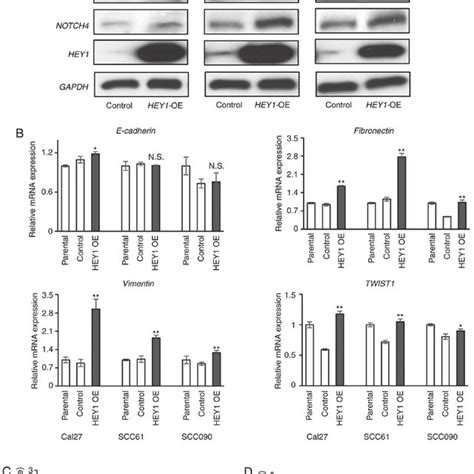 Emt Phenotypes In Hey1 Oe Cells A Western Blot Analysis Of