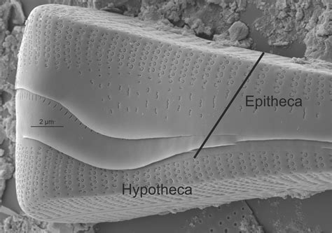 Glossary Diatom Flora Of Britain And Ireland