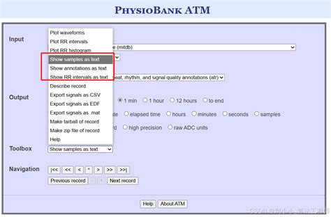 「ecg信号处理——（2）mit Bih数据库在线分析（atm）」2024年11月4日 Csdn博客