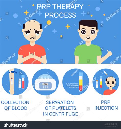 Platelet Rich Plasma Injection Procedure Prp Stock Vector Royalty Free