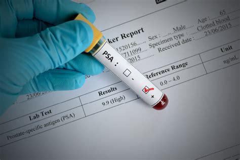 Do Men Need Prostate Cancer Screenings Wellmark Blue