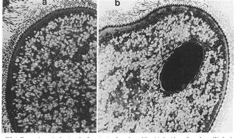 Figure 1 From Rumen Holotrich Ciliate Protozoa 27 Semantic Scholar