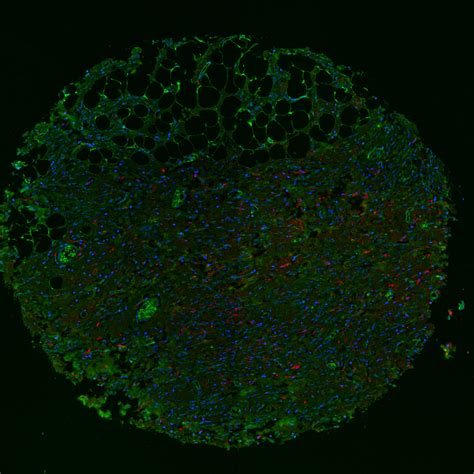 Colocalization Analysis Image Analysis Imagesc Forum