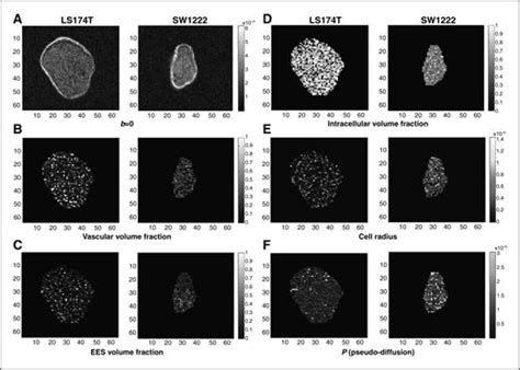 Noninvasive Quantification Of Solid Tumor Microstructure Using Verdict Mri Cancer Research