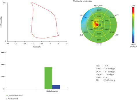 Pressure Strain Loop And 17 Segments Of The Left Ventricular Myocardium