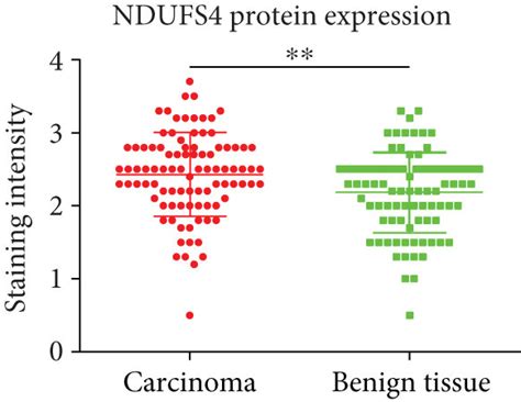 Oxphos Complex Expression In Prostate Carcinomas And Corresponding
