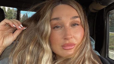 Im Koma Jackie Miller James Familie Ist Gerührt Von Fans